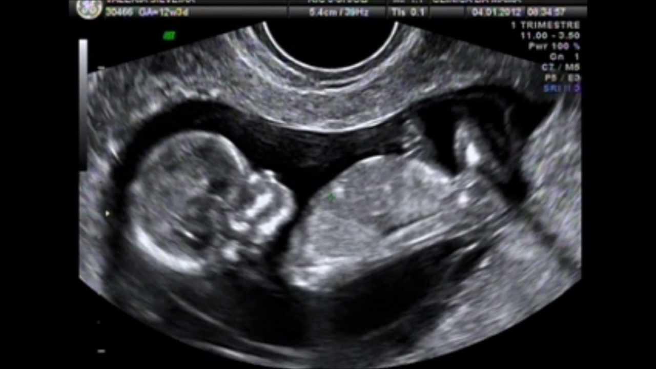 Ultrassom: Tudo o que você precisa saber - Mamãe & Cia